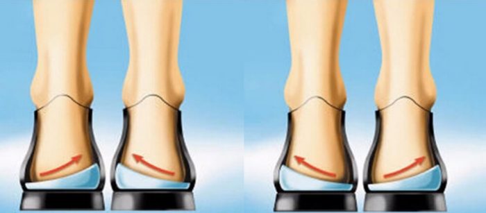 Knickfuss - Der Fussexperte